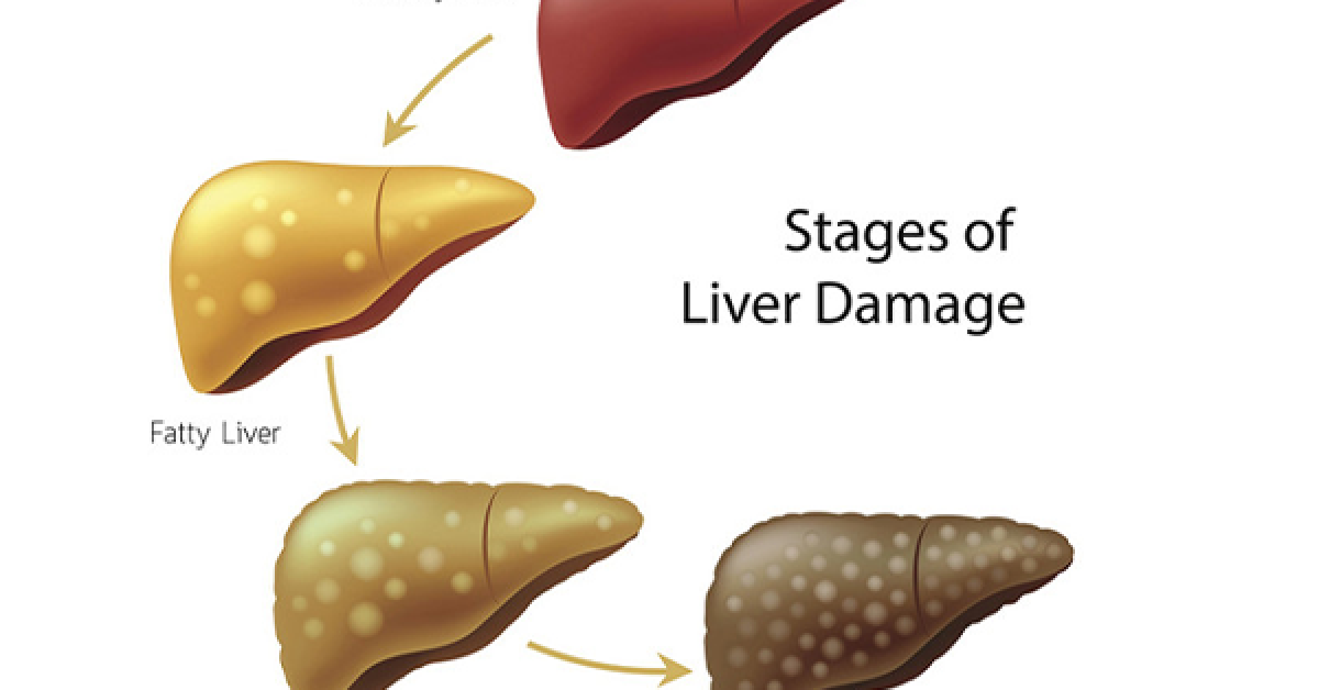 Study Shows How Liver Damage from Stress and Aging Might Be Reversible ...