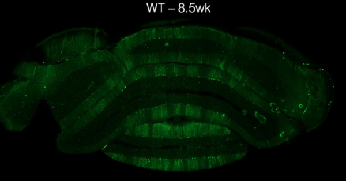 Striped gene expression pattern provides clues for neurodegenerative ...