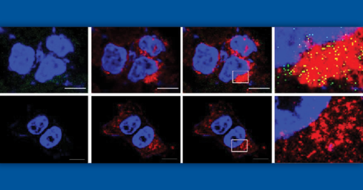 Scientists Hack Cell Entry to Supercharge Cancer Drugs | Duke ...