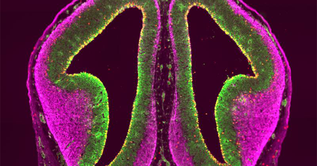 What Makes Us Human | Duke University School of Medicine