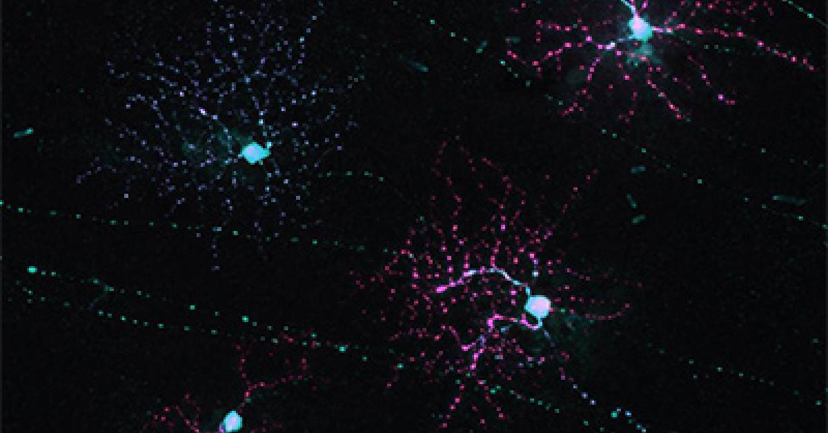 Real neurons are noisy. Can neural implants figure that out? | Duke ...